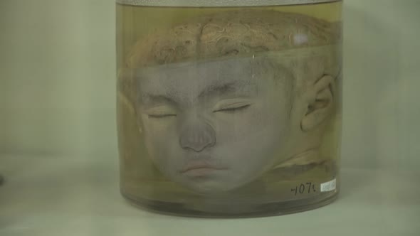 Anatomical Human Specimens in Formalin, Stock Footage | VideoHive