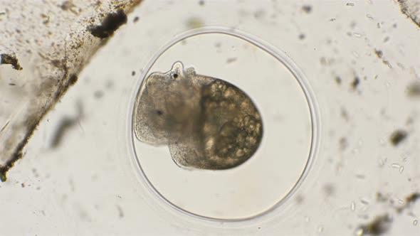 Movement of the Formed Cochlea Embryo, Under a Microscope, Stock Footage