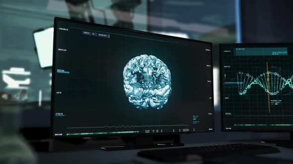 Computer Screen Displays Medical Program To Hold Patient Brain ...