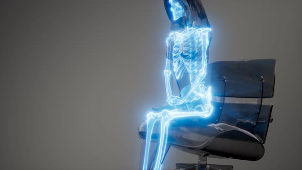 Human Skeleton Radiography Scan, Motion Graphics | VideoHive