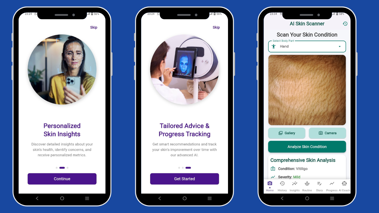 AI Dermatologist - Skin Scanner Flutter App Dermat AI for Skin Disease ...