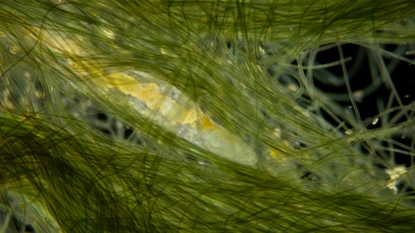 Worm Nais Sp. Under a Microscope, the Tubificidae Family, a Subclass of ...