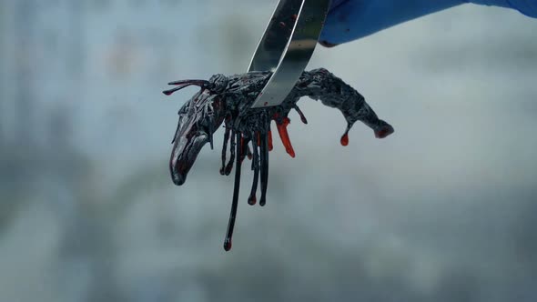 Alien Implant Removed From Patient, Stock Footage | VideoHive