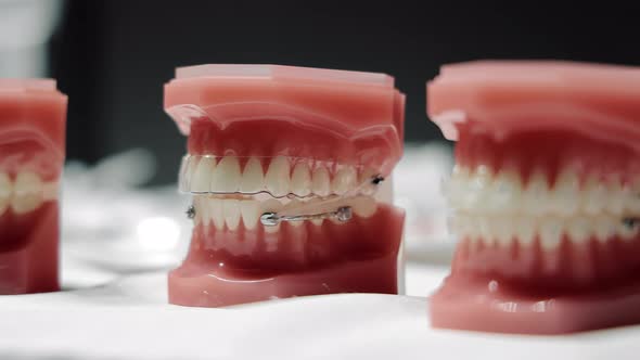 Model of the Tooth Gap on the Placement of Orthodontic Brackets, Stock ...