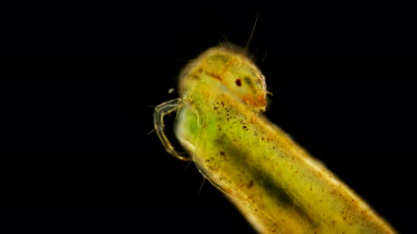 Trichoptera Larvae Under the Microscope, Stock Footage | VideoHive