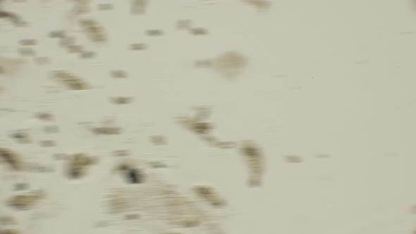 Colony of Ciliates Coleps, Prey on Bacteria, Which Are Very Much in ...