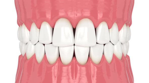 Human jaw with open gingival embrasure, Motion Graphics | VideoHive