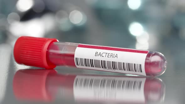 Bacteria antibody vial in medical lab, Stock Footage | VideoHive