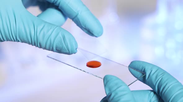 A Close-up of a Red Blood Drop Dropping From a Pipette Onto Laboratory ...