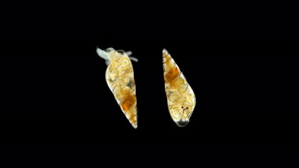 Under the Microscope, the Marine Snail, Class Gastropoda, Type Mollusca ...