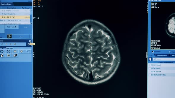 Interface of an MRI Computer Program During Head Scanning, Stock Footage
