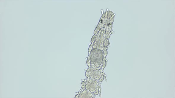 Worm Family Syllidae Under a Microscope Polychaeta Class Exogoninae ...