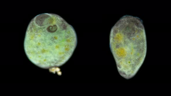 Infusoria Stentor Under the Microscope, the Family Stentoridae, Class ...