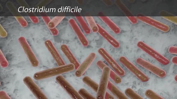 Clostridium difficile is a type of bacteria that causes colitis, a ...