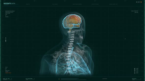Medical Anatomy Interface Projects Human Brain Health Scan At Hospital ...