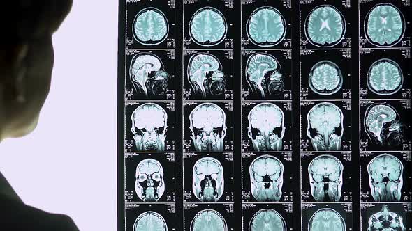 Young Neurosurgeon Calculating Degree of Patients Brain Concussion on ...
