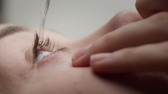Closeup Shooting of Dripping Into Eyes From an Eyedropper, Stock Footage