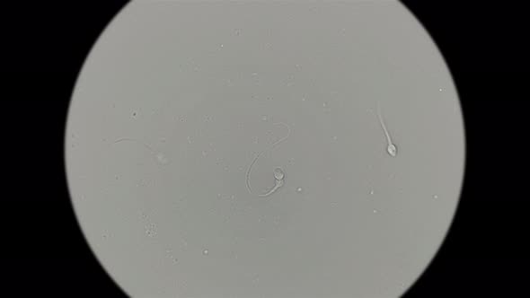 Human Sperm Under a Microscope (Spermatozoa), Consists of Sperm and ...