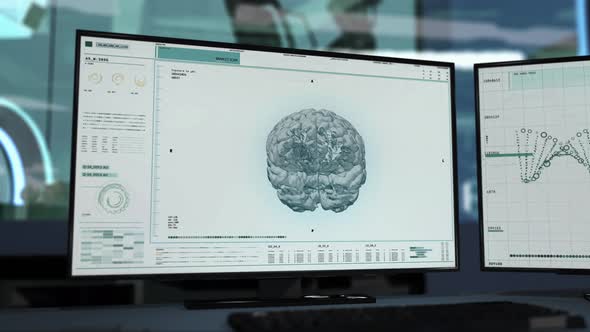 Examination Of Patient's Brain In Modern Interface Of Neurosurgery ...