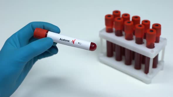 Negative Acetone Test, Doctor Showing Blood Sample, Lab Research Health ...