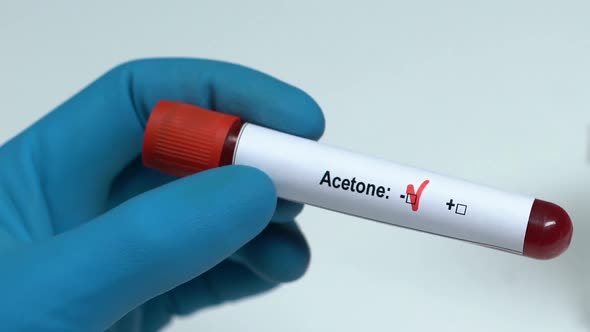 Acetone, Doctor Holding Blood Sample in Tube Close-Up, Health ...