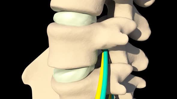 inflammation of the Sciatic Nerve, Motion Graphics | VideoHive
