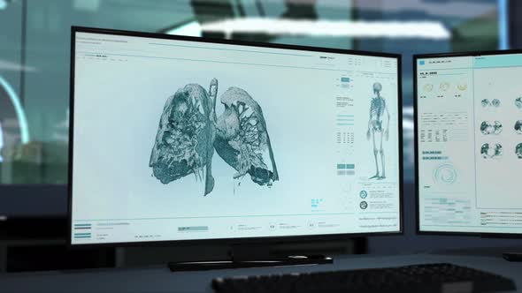Patient Health Examination On Advanced X-ray Screening Software ...