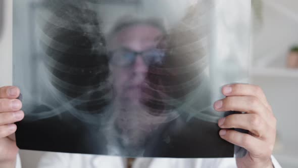 Chest Scan Xray Examination Doctor Studying Ribs, Stock Footage | VideoHive