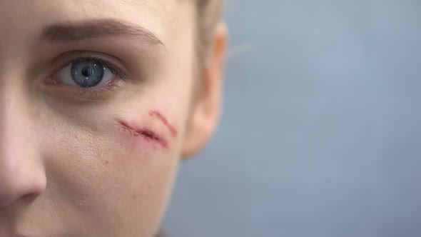 Defenseless Female With Scars on Her Face Looking Into Camera, Domestic ...