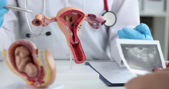 Demonstration Model of Female Reproductive System of Gynecologist in ...