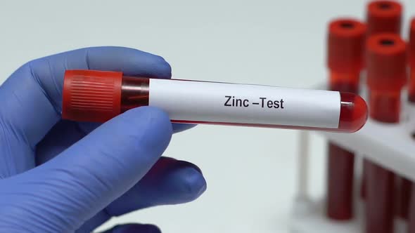 Zinc-Test, Doctor Holding Blood Sample in Tube Close-Up, Health ...