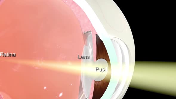Anatomy of the Eye. Loss of vision in the eye, Motion Graphics | VideoHive