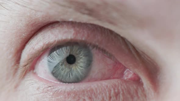 Gray Eye of Middleage Caucasian Male Brightly Lit Closeup, Stock Footage