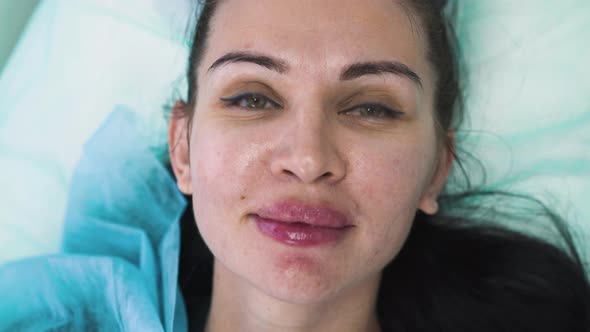 Lady with Inflamed Lips After Augmentation Procedure, Stock Footage
