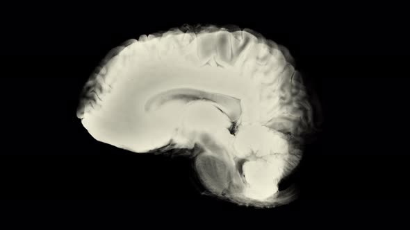 MRI Brain Scan Sideview, Motion Graphics | VideoHive