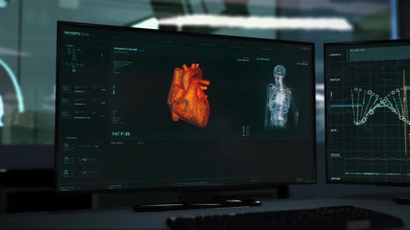 Modern Diagnostic X-ray Analysis System Ui Checks Health Of Heart Organ ...