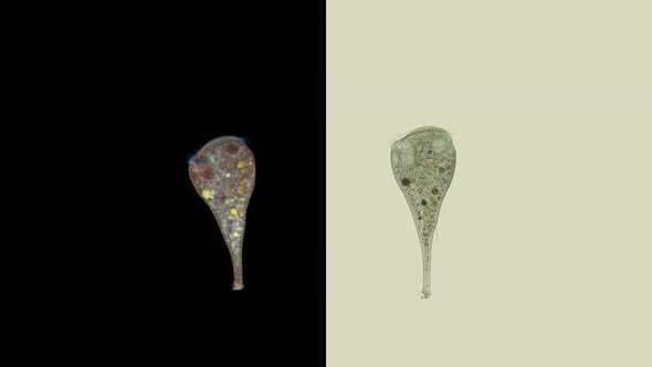 Infusoria Stentor Under the Microscope, the Family Stentoridae, Class ...