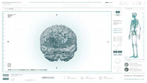 Innovative Medical Biology Scanner System Discovers Brain Tumor ...