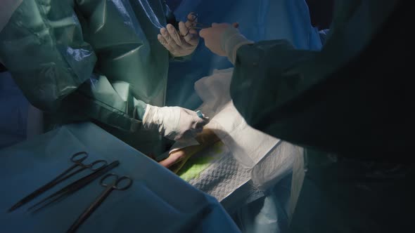 Doctors Doing Surgery On Arm, Stock Footage | VideoHive