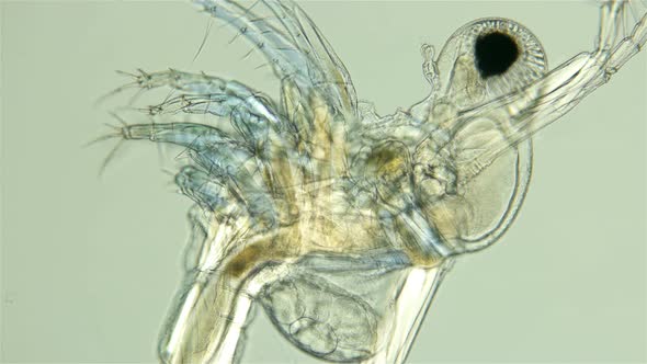 Zooplankton Under a Microscope, Prickly Water Flea, Stock Footage ...