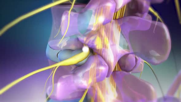 Medical Animation of Nerve compression syndrome, Motion Graphics ...