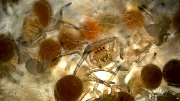 Spider under a microscope, Arachnida class, Stock Footage | VideoHive