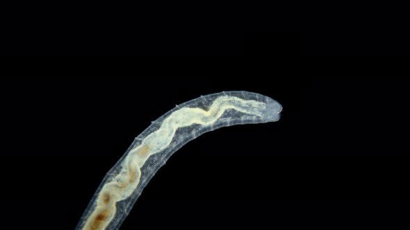 the Worm Enchytraeus Sp, Stock Footage | VideoHive