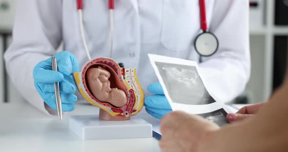 Gynecological Examination of Model of the Uterus and Fetus of Child ...