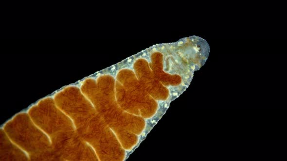 Leech of the family Glossiphoniidae under a microscope, order ...