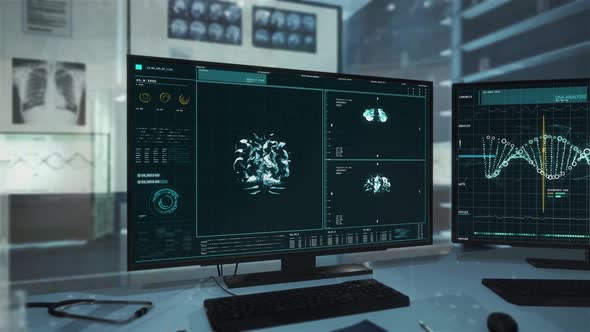 Monitor Showing Brain Analysis In Innovative Neurology Research ...