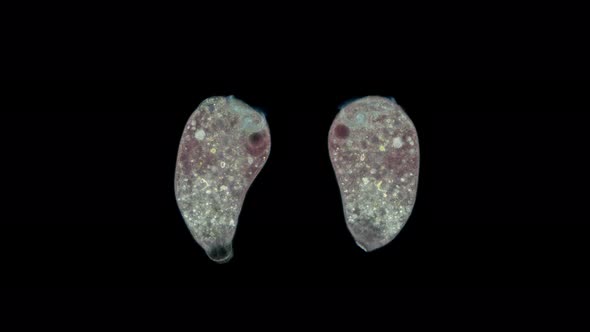 Infusoria Stentor Under the Microscope, the Family Stentoridae, Class ...