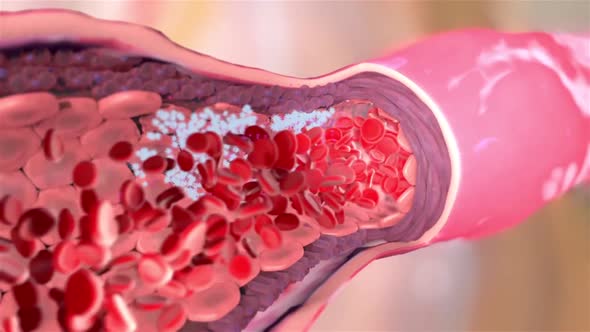 Blood clotting in the circulatory system, Motion Graphics | VideoHive