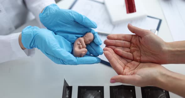 Doctor Holding in His Hands Anatomical Model of Human Fetus in Front of ...