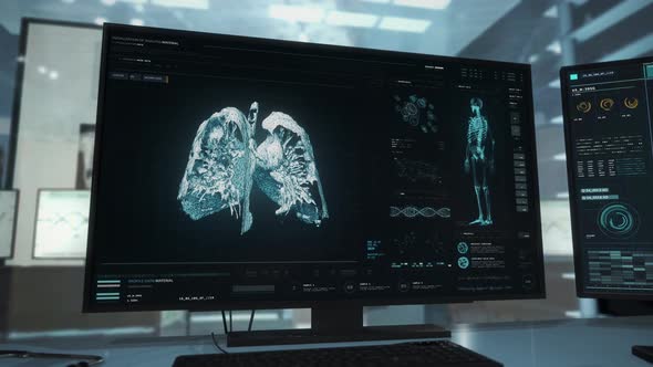 Futuristic hospital x-ray system identifies the deadly cancer in the ...